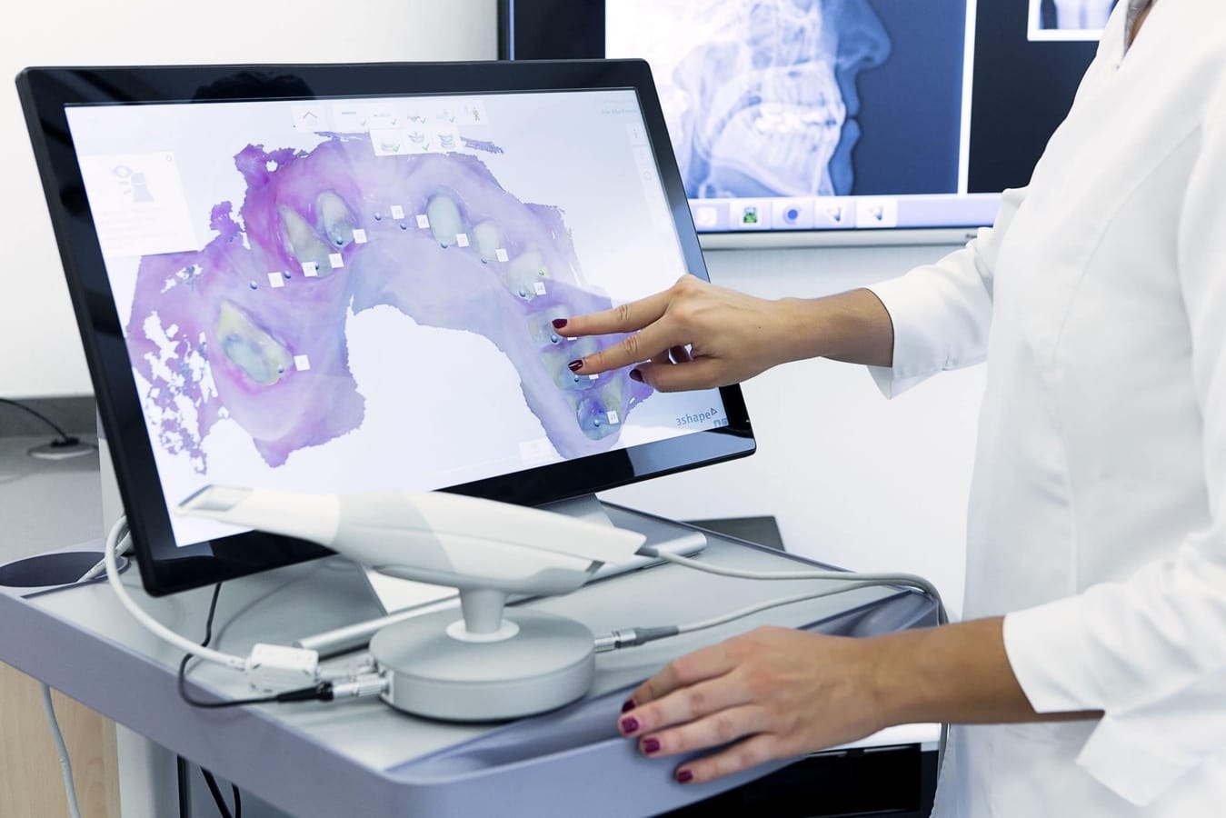 Why An In-House Digital Dentistry Lab? - Potomac Dental Centre